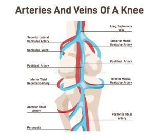What to Expect During Genicular Artery Embolization