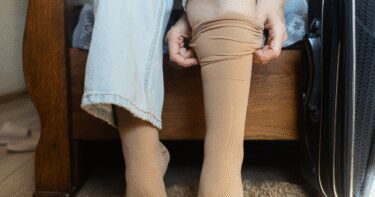 Understanding Venous Reflux: Symptoms and Treatment Options